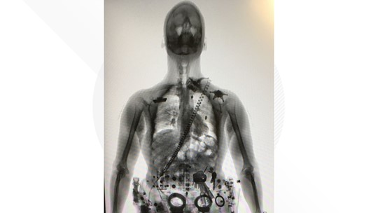 Ada County Jail installs body scanners to help catch contraband | ktvb.com