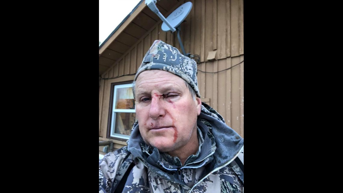 Idaho man survives grizzly bear attack in Montana wilderness | ktvb.com