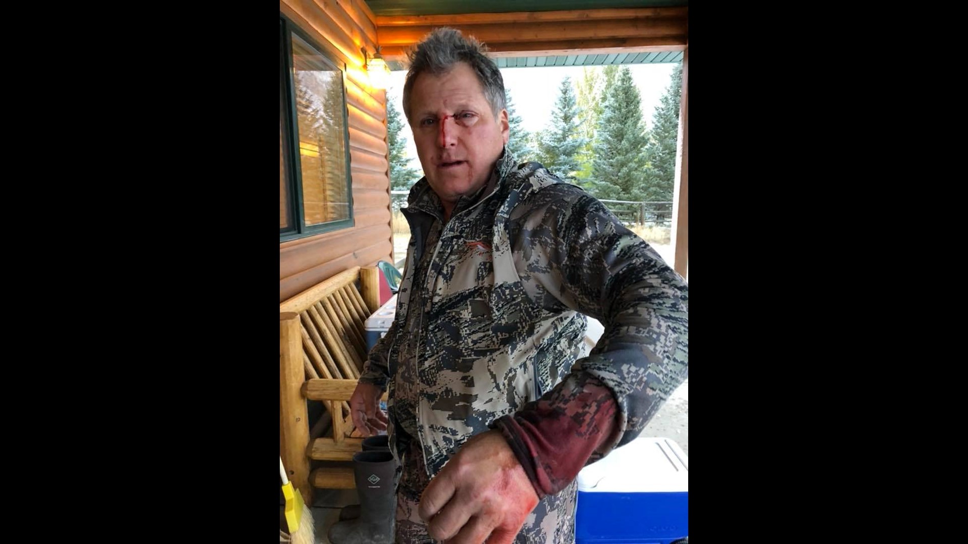 Idaho man survives grizzly bear attack in Montana wilderness | ktvb.com