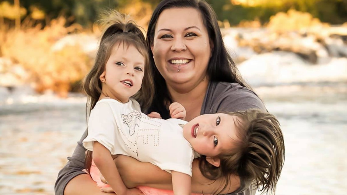 7's HERO: Idaho conjoined twins Callie and Carter are beating the odds ...