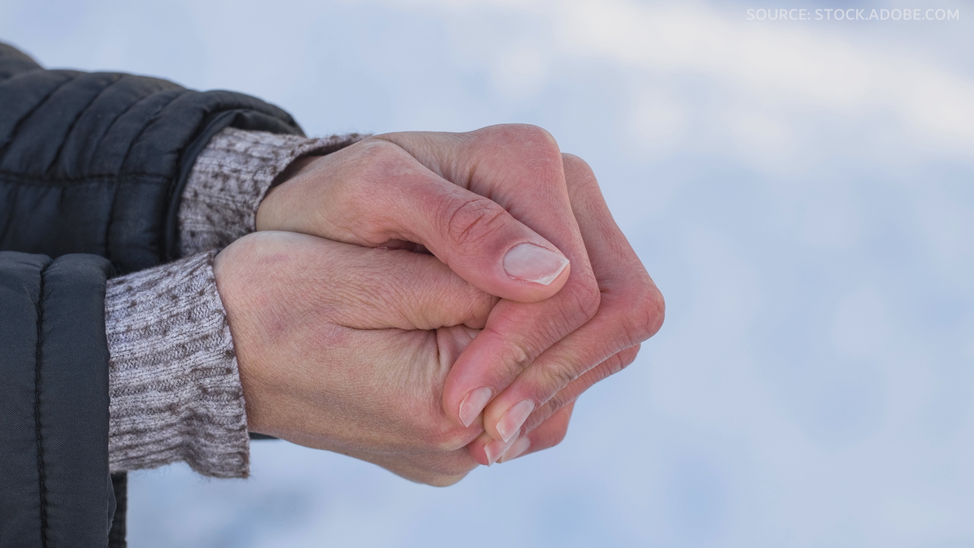 What is frostbite? Here’s how to spot the signs early | ktvb.com